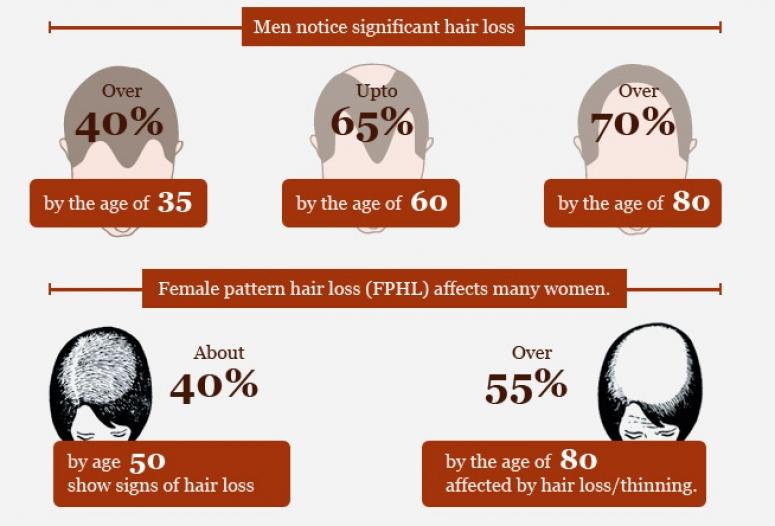 Hair Facts | Transitions Hair Solutions